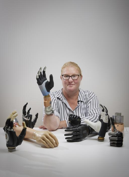 World's First 'Real Bionic Woman' Equipped With Controllable Artificial ...