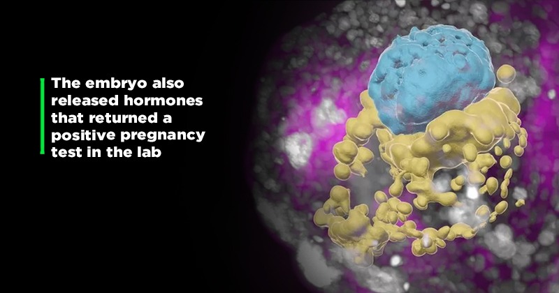 Scientists Grow Human-Like Embryo Model Without Involvement Of Sperm Or Egg
