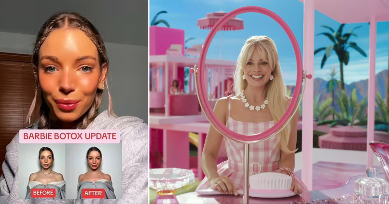 'Barbie Botox' Trend Inspired By Margot Robbie