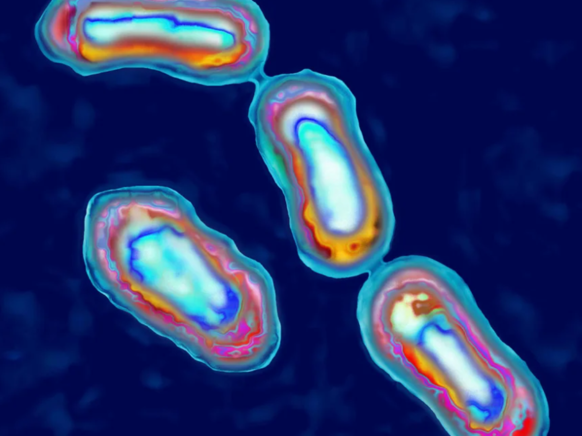 Rare Case Of 'Black Death', That Killed 50 Million In 14th Century ...