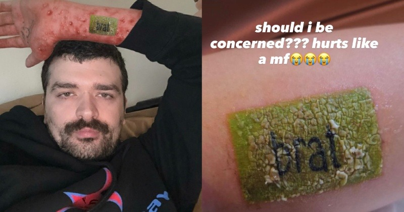 Tattoo nightmare Xiu Shoegaze’s 'Brat' ink infection becomes a viral ...