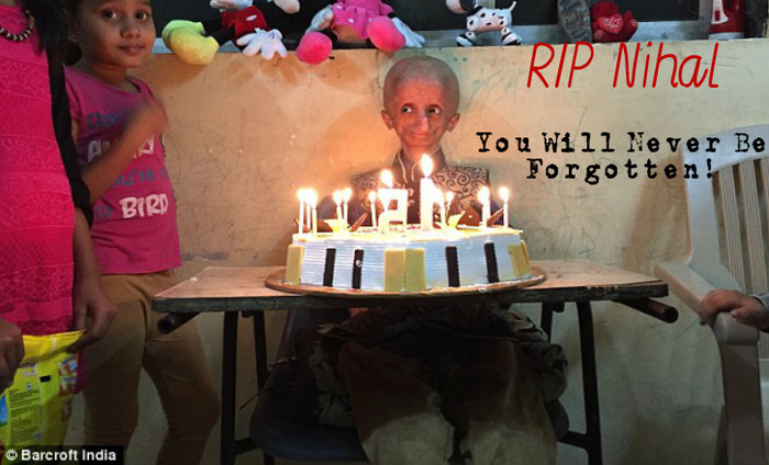 Nihal, The Face Of Progeria In India, Dies At 15 In Telangana