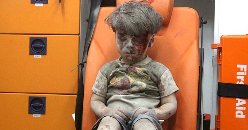 5-YO Syrian Boy Whose Picture Shocked The World Breaks Into Tears After ...