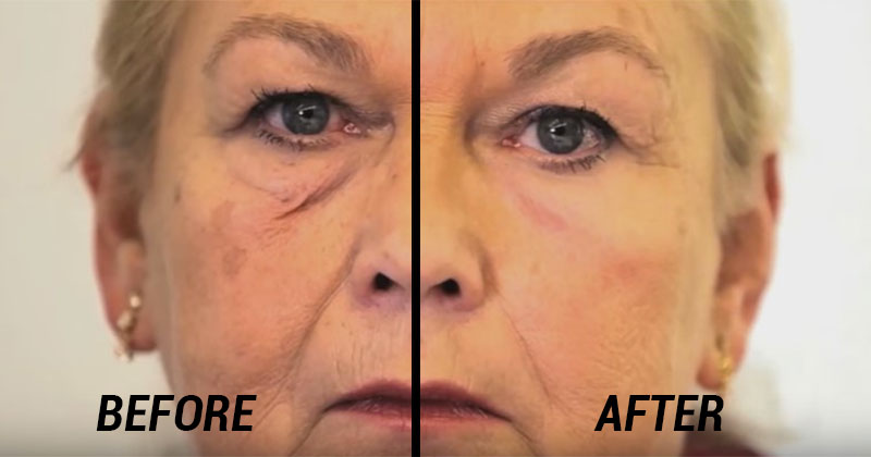 Scientists At MIT Just Invented A Cream That Makes Wrinkles Disappear