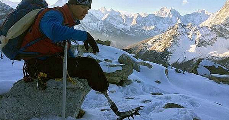 In 2013, He Lost His Legs To An Explosion. Now He's The World's First ...