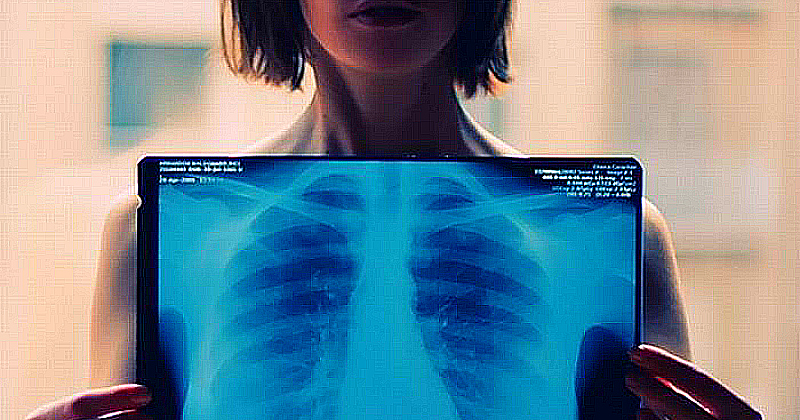 Sex Workers Are X-Raying Girls Joining The Flesh Trade To See If They ...