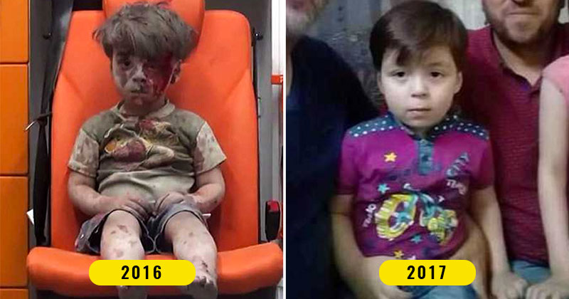 New Pics Of Syrian Boy, Who Became The Symbol Of Aleppo's Suffering ...