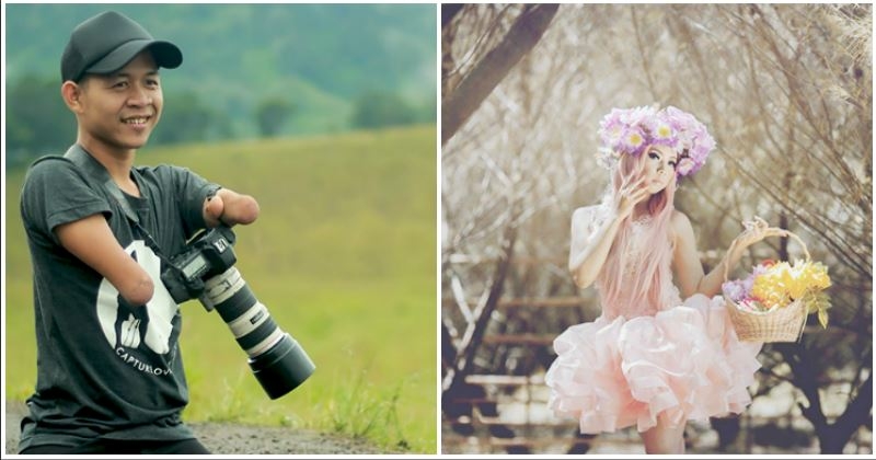 Photographer Born Without Hands Or Feet Is Doing A Better Job With The ...