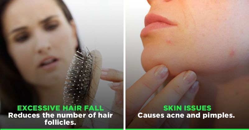 7 Subtle Signs Of Stress You Need To Be Wary Of