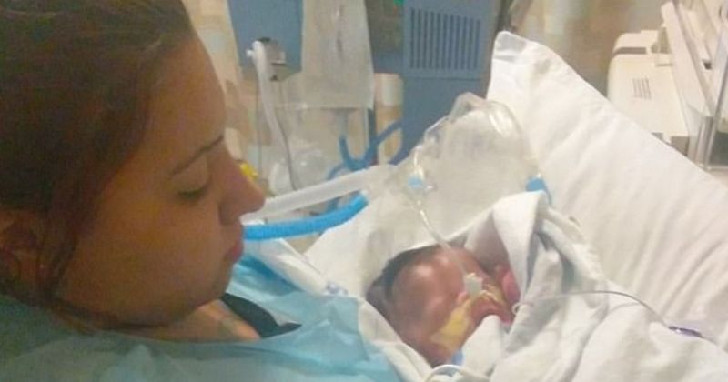 Doctors In Texas Are Struggling To Save Baby Born With Nearly No Skin