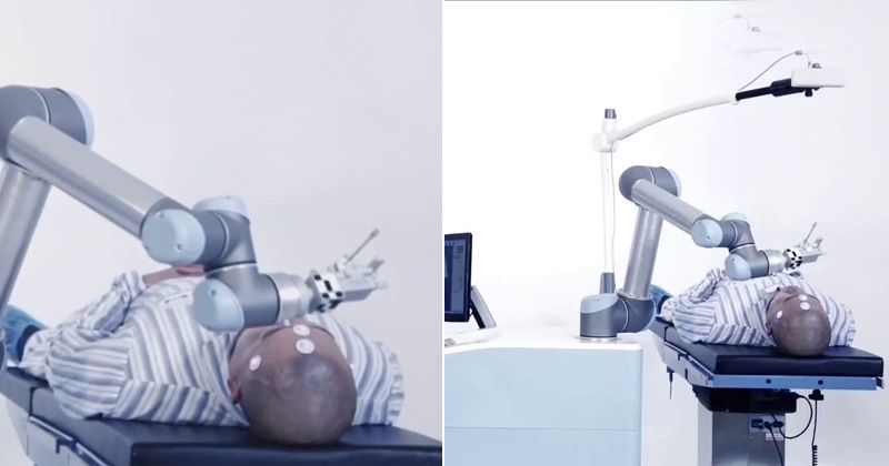 China’s First Neurosurgery Robot Has Started Working, And It's Called ...