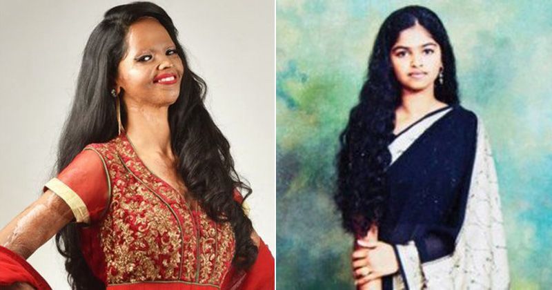 Acid Attack Survivor Laxmi Agarwal Says 'Attack Didn't Scar My Dreams ...