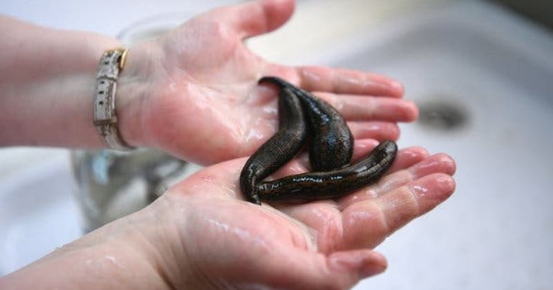 Man Complains Of Non-Stop Coughing, Doctors Find Two Leeches Inside His ...