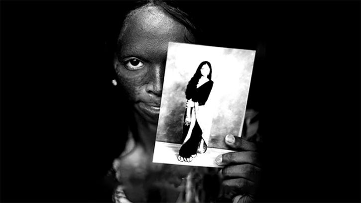 These Horrific Survivor Stories Of Acid Attack Victims Will Show You ...