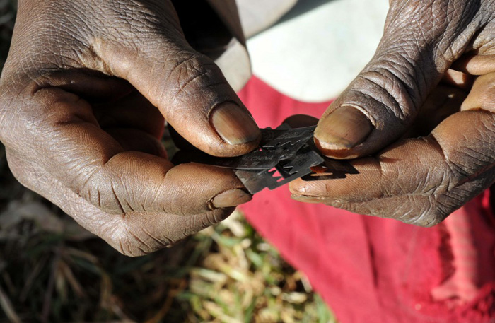 17 Year Old Egyptian Girl Dies During A Banned Genital Mutilation Surgery
