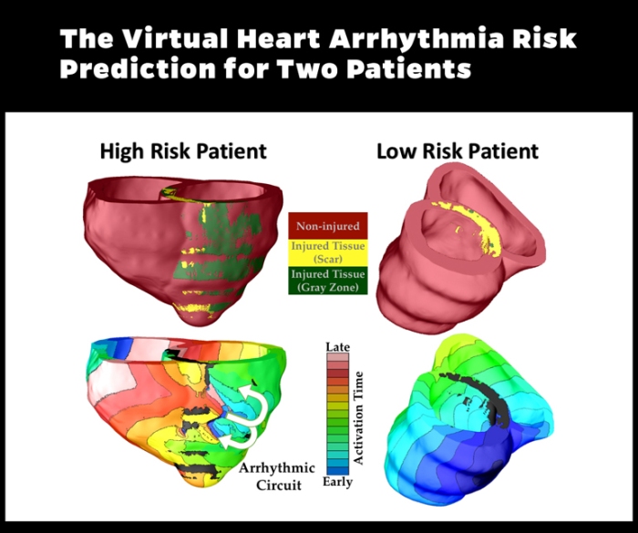 This Virtual 3D Heart Can Predict If You're Having A Sudden Heart Attack