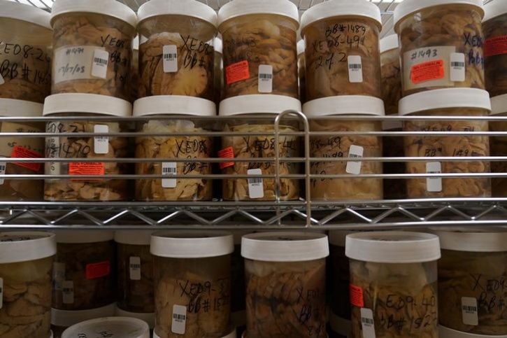 15 Pictures Of Human Brain Bank That Stores Thousands Of Brains For ...