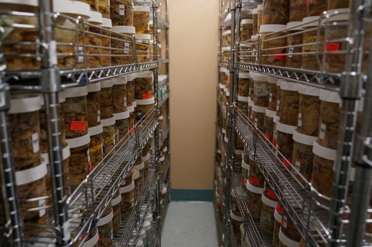 15 Pictures Of Human Brain Bank That Stores Thousands Of Brains For ...