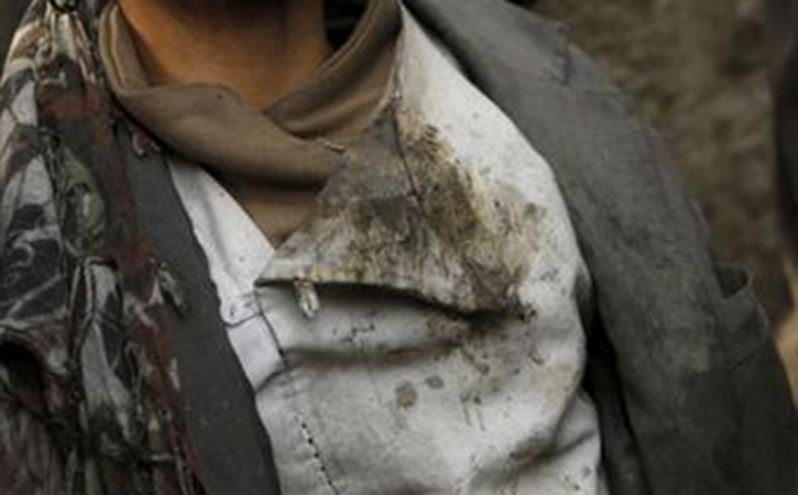 Why Your Clothes Can Increase Your Chances Of Infecting A Urinary Tract ...