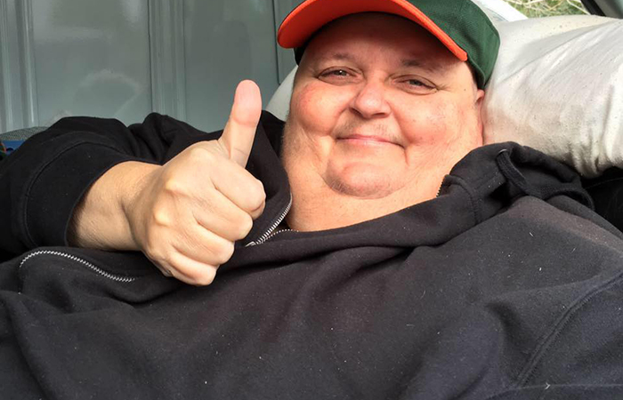 Initially Assumed Just Fat, This Mississippi Man Actually Had A 60 Kg ...