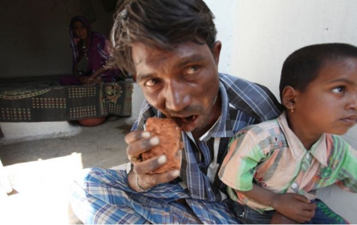 This 30-Year-Old Man From Karnataka Only Eats Mud, Rocks, And Bricks ...