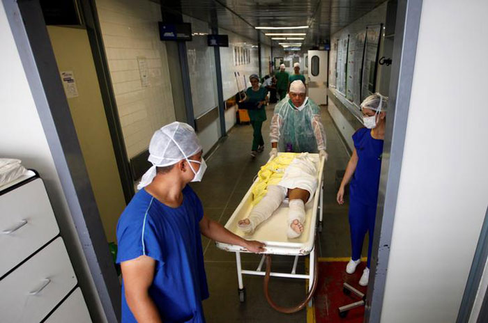 Ingenious Doctors In Brazil Are Using Fish Skin To Help Heal Burn Victims