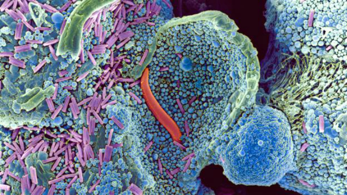 Diseases That Have Been Trapped Under Ice Are Beginning To ‘Wake Up ...