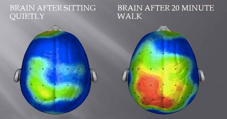 Did You Know Exercise Increases The Size Of Your Brain For The Better?