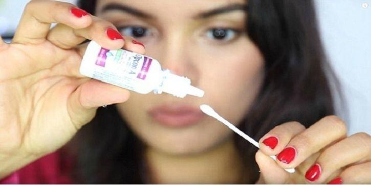 Tired Of Recurring Pimples? Here Are Simple Home Remedies That'll Help ...