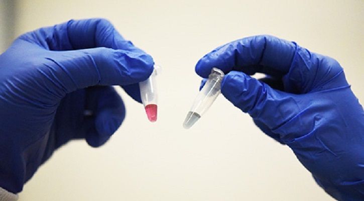 Scientists Can Now Detect Cancer In Just 10 Minutes, With A New Cheap ...