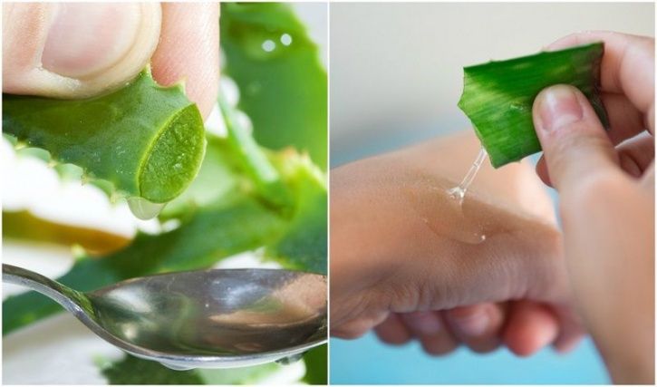 5 Home Remedies To Get Rid Of Pimples As Fast As Possible