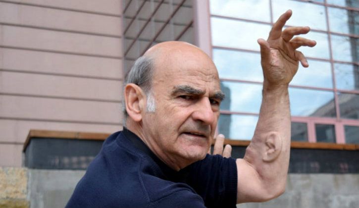 This 71-Year-Old Is Growing An Ear Inside His Arm, So You Can Listen To ...