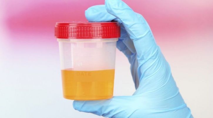 Here’s What Your Pee Is Trying To Tell You About Your Health
