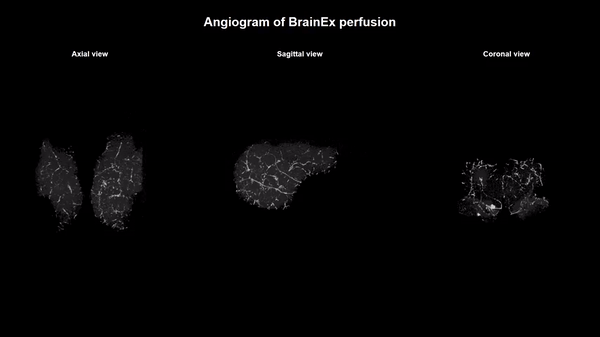 Scientists Revive Brain Cells In Pigs Hours After They Died, And It ...