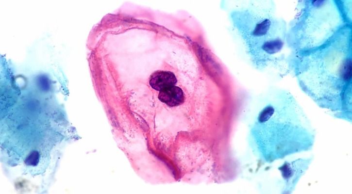 11 Medical Breakthroughs That Will Make Us All Healthier Human Beings ...