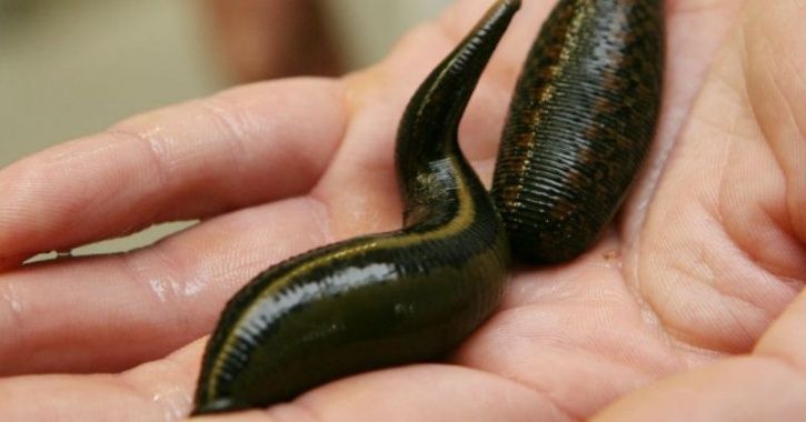Man Complains Of Non-Stop Coughing, Doctors Find Two Leeches Inside His ...
