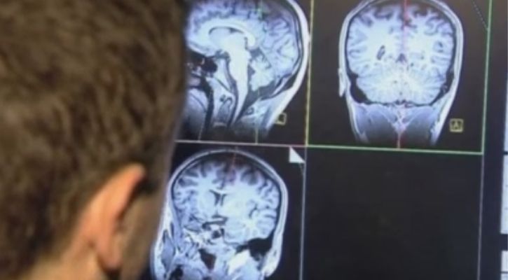 Indians Have The Smallest Brain In The World, Reveals New Study At IIT ...