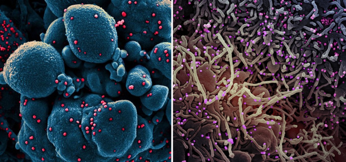 Coronavirus Under A Microscope